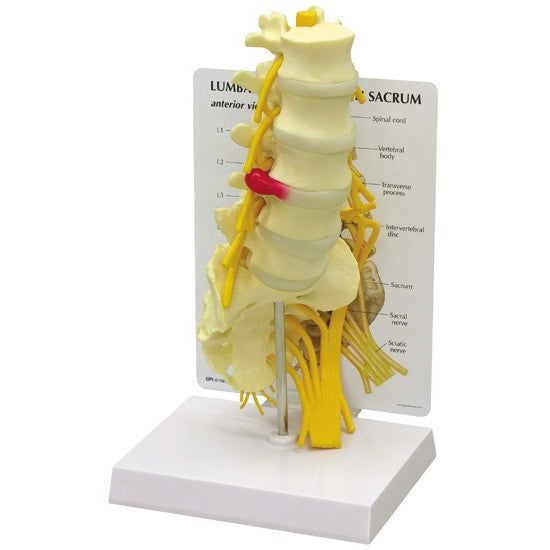 Lumbar Spine Model with Sacrum 1700 | Lower Back Anatomy | GPI ...