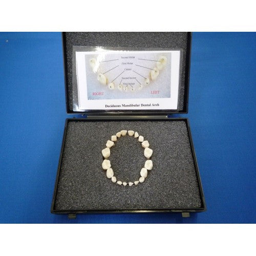 Deciduous Teeth Set (20 part) 780S | Complete Set Of First Teeth | ESP ...