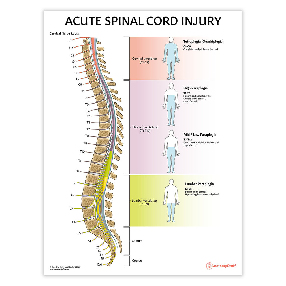 Acute Spinal Cord Injury Chart / Poster - Laminated | AnatomyStuff