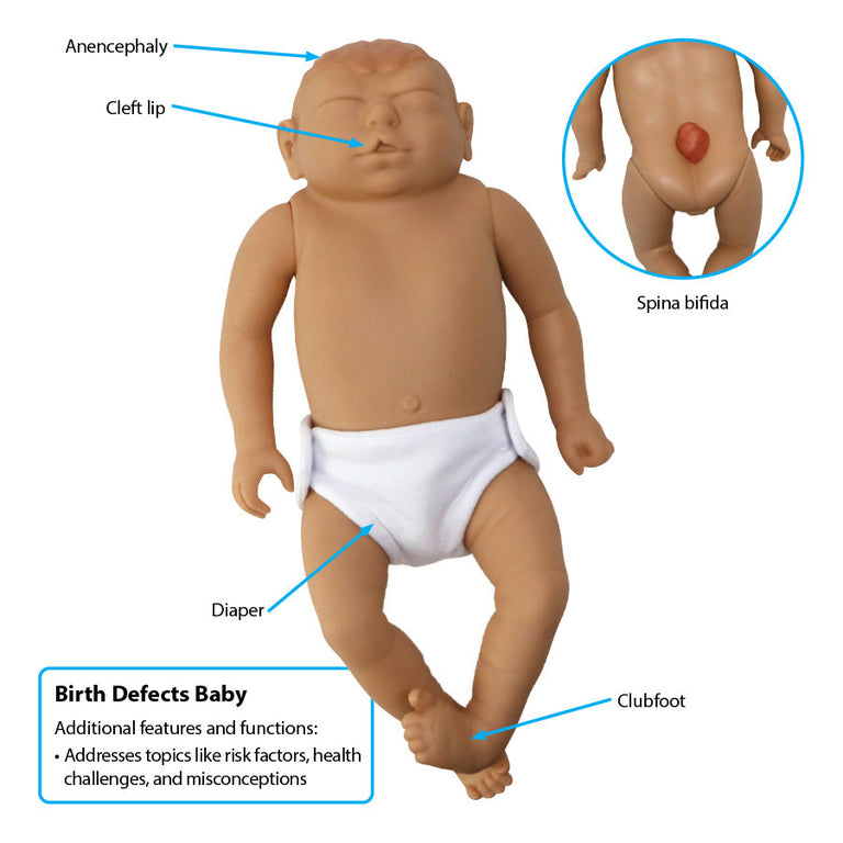 Birth Defects and Disorder Model Set | Obstetrics Models | AnatomyStuff