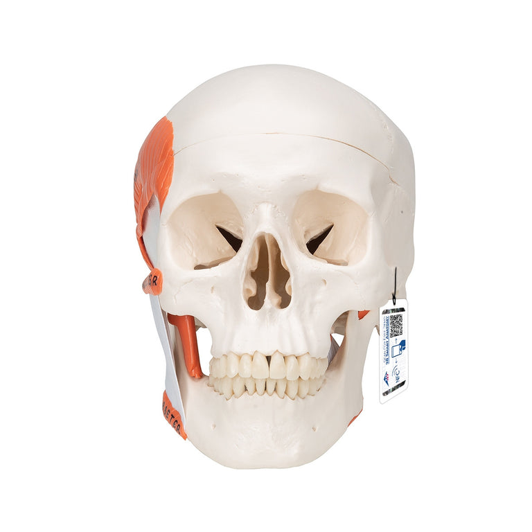 TMJ Skull Model with Muscles 1020169 A24 | Temporal Mandibular Joint ...