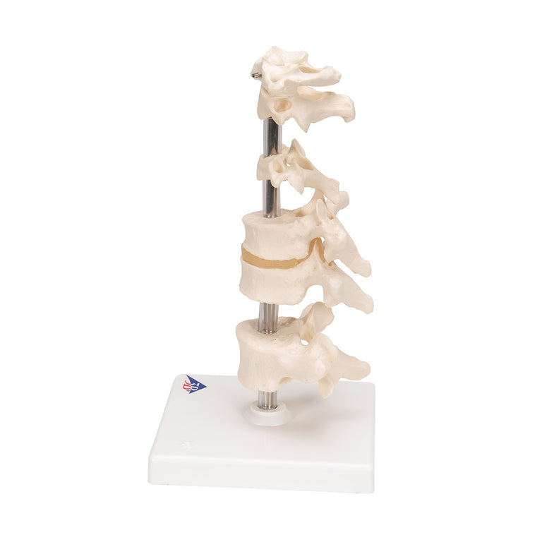 Mounted Vertebrae Model A75 / 1000147 | Vertebra Bone Replica | 3B ...