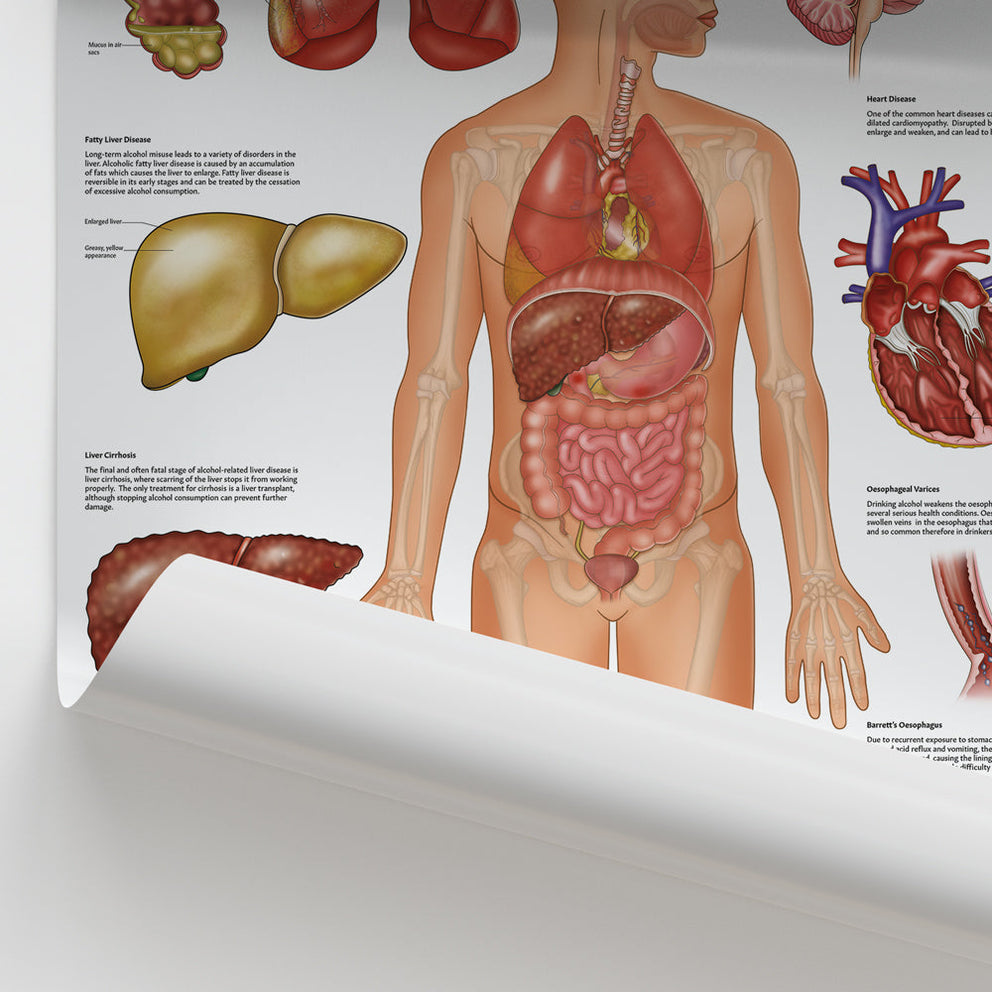 Alcohol and The Body Poster | Alcoholic Education Drink Aware ...