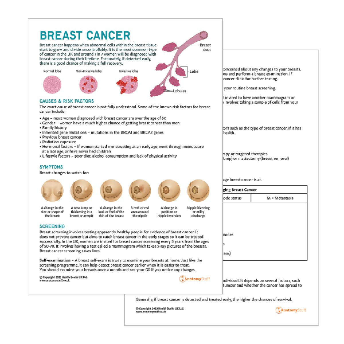 Breast Cancer Patient Education Printout | AnatomyStuff