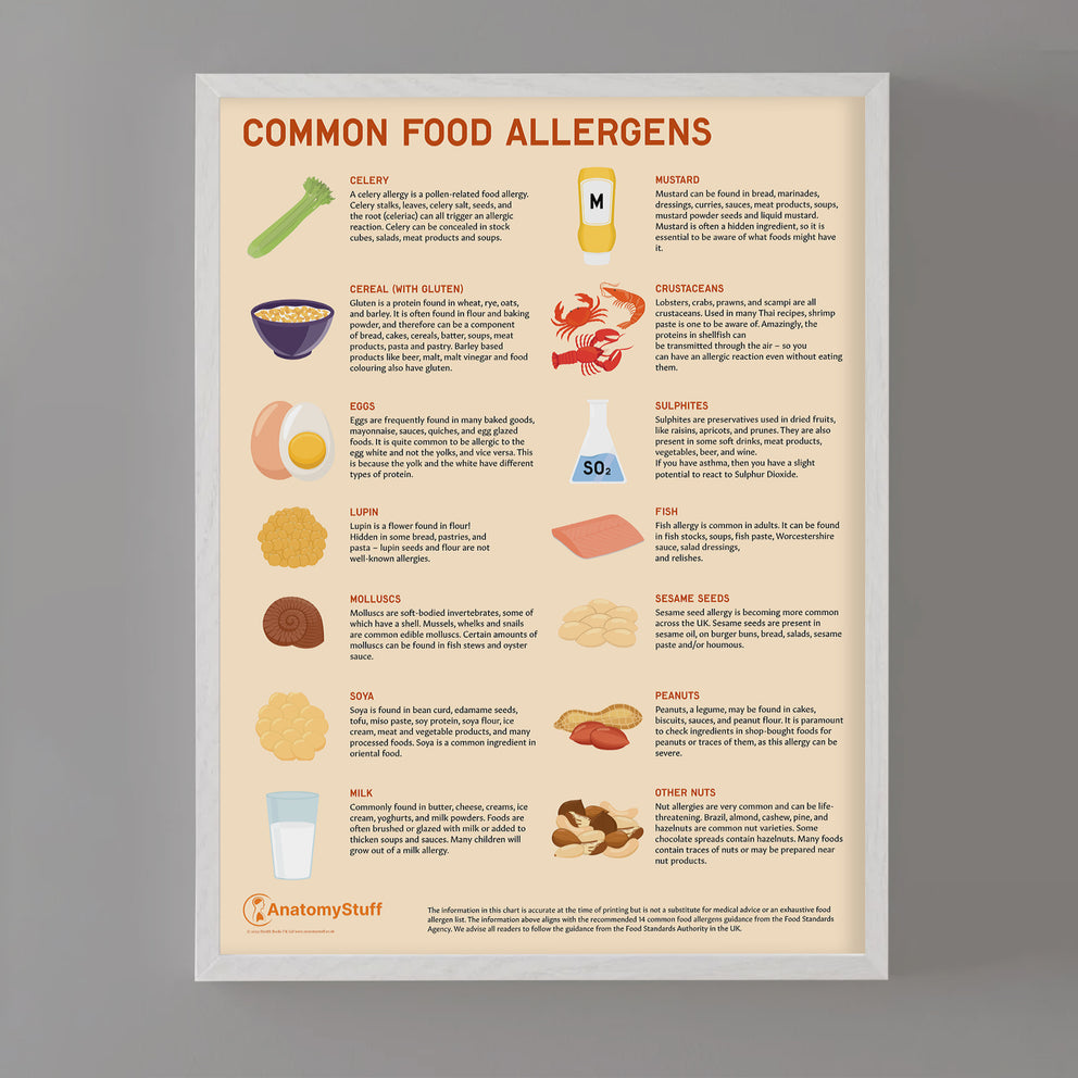 Common Food Allergens Poster | Food Allergy Awareness Chart – AnatomyStuff