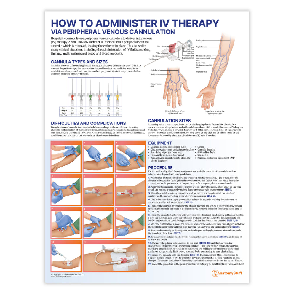 How to Administer IV Therapy Poster | Guide to Intravenous Therapy ...