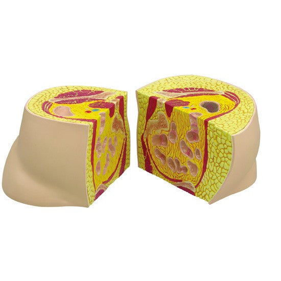 Obesity Model 3600 | Body Type (Apple / Pear) Anatomy Model | Fat Model ...