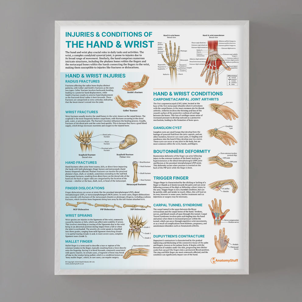 The Anatomy of The Hand & Wrist Chart | Injuries & Conditions Poster ...