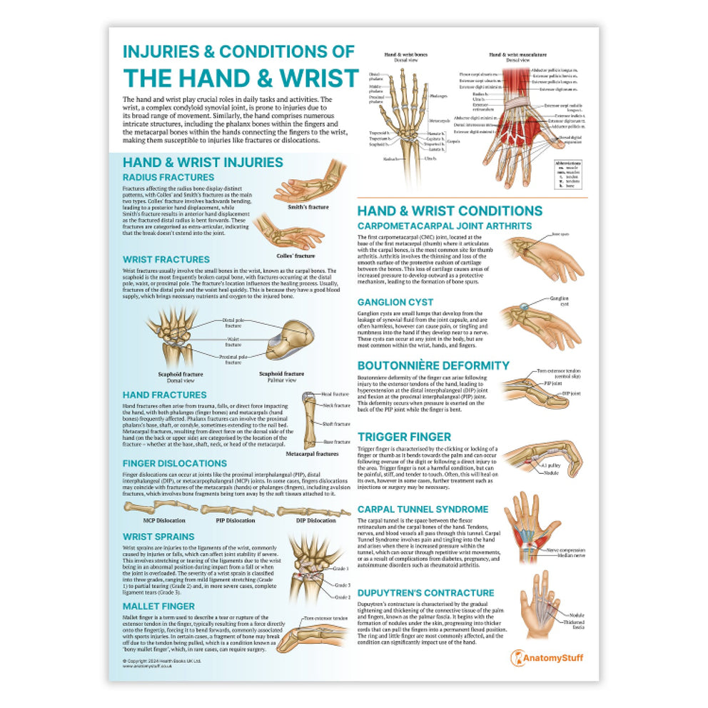 The Anatomy of The Hand & Wrist Chart | Injuries & Conditions Poster ...
