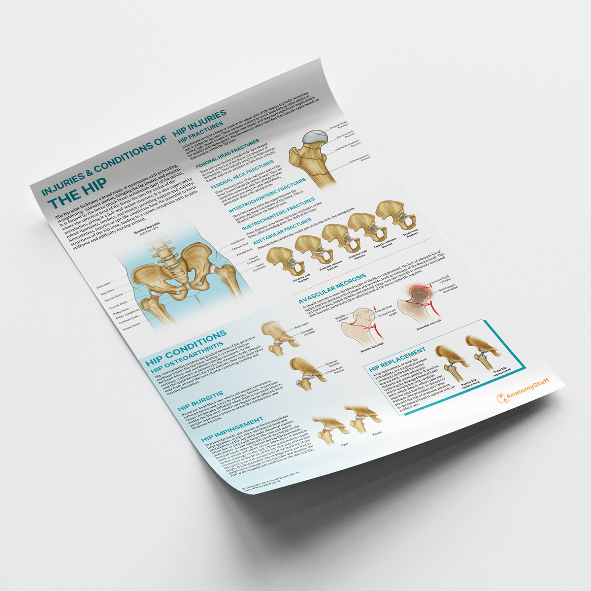The Anatomy of The Hip Chart / Poster | Conditions & Injuries ...