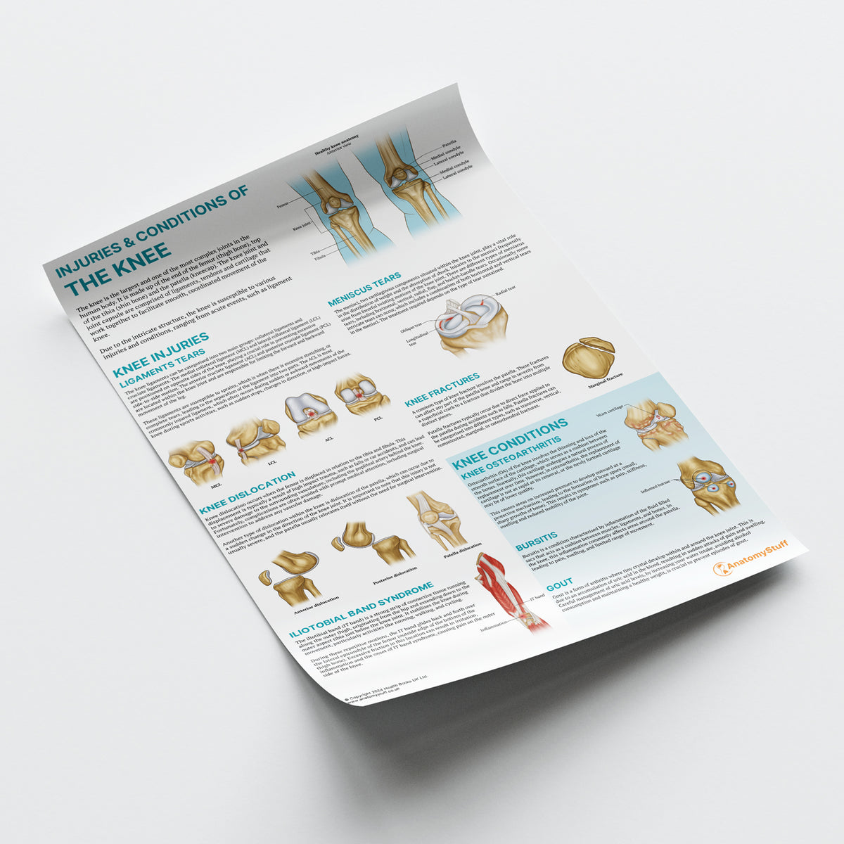 The Anatomy of The Knee Chart / Poster | Conditions &Injuries ...