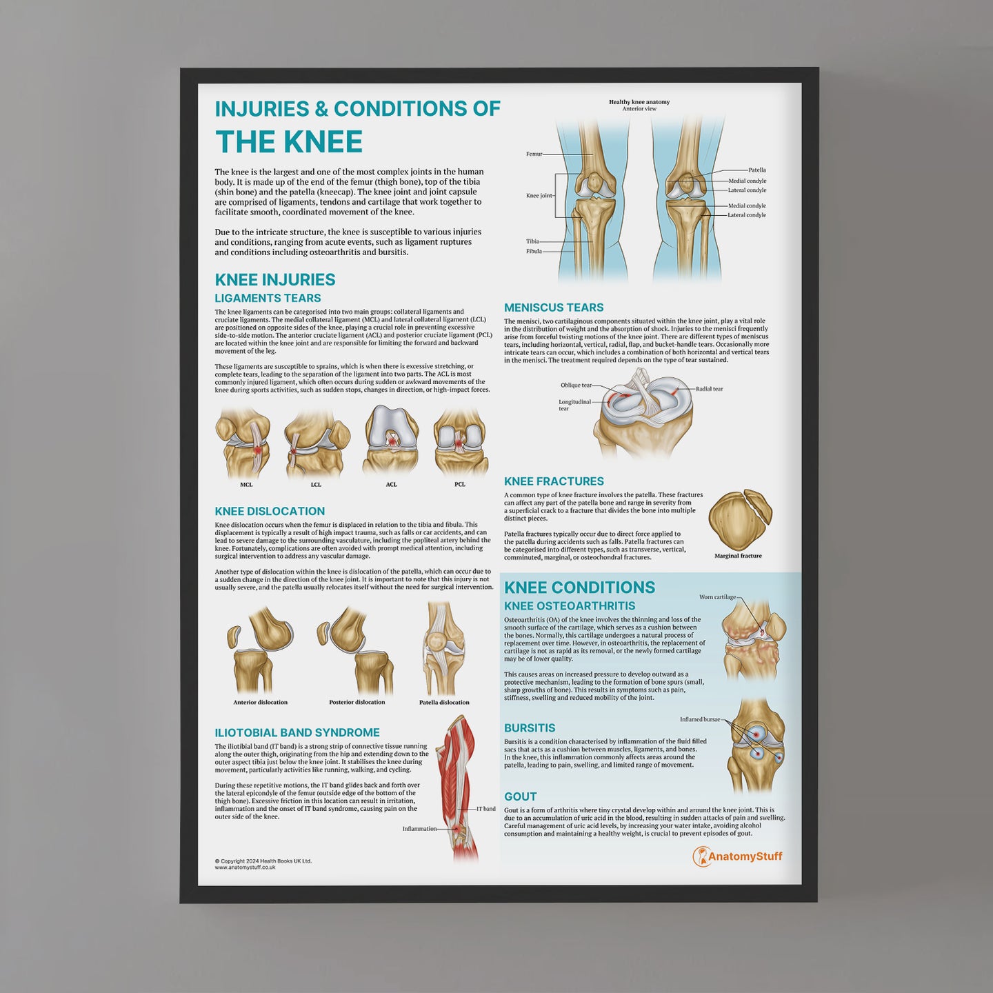 The Anatomy of The Knee Chart / Poster | Conditions &Injuries ...