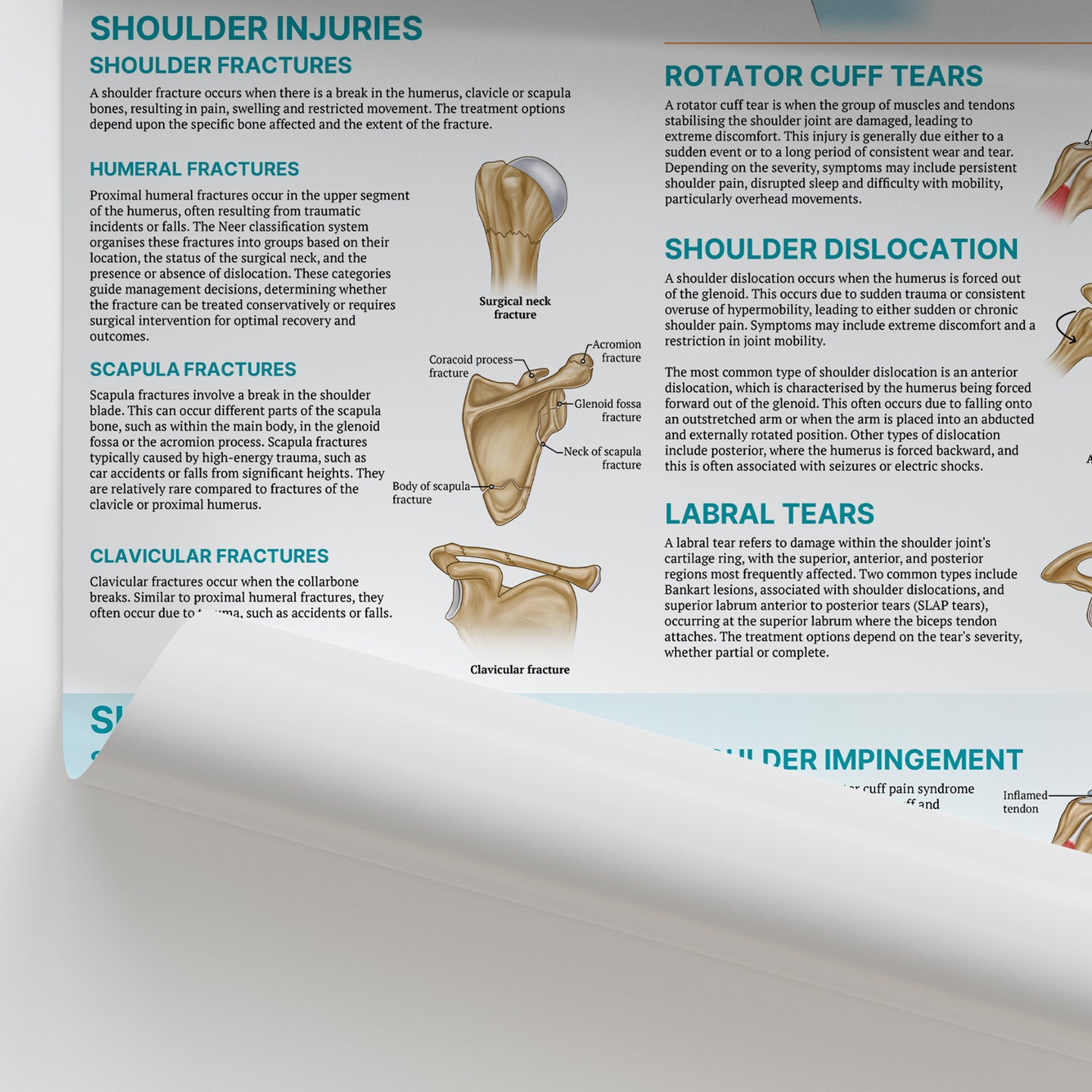 The Anatomy of The Shoulder Chart | Injuries & Conditions Poster ...