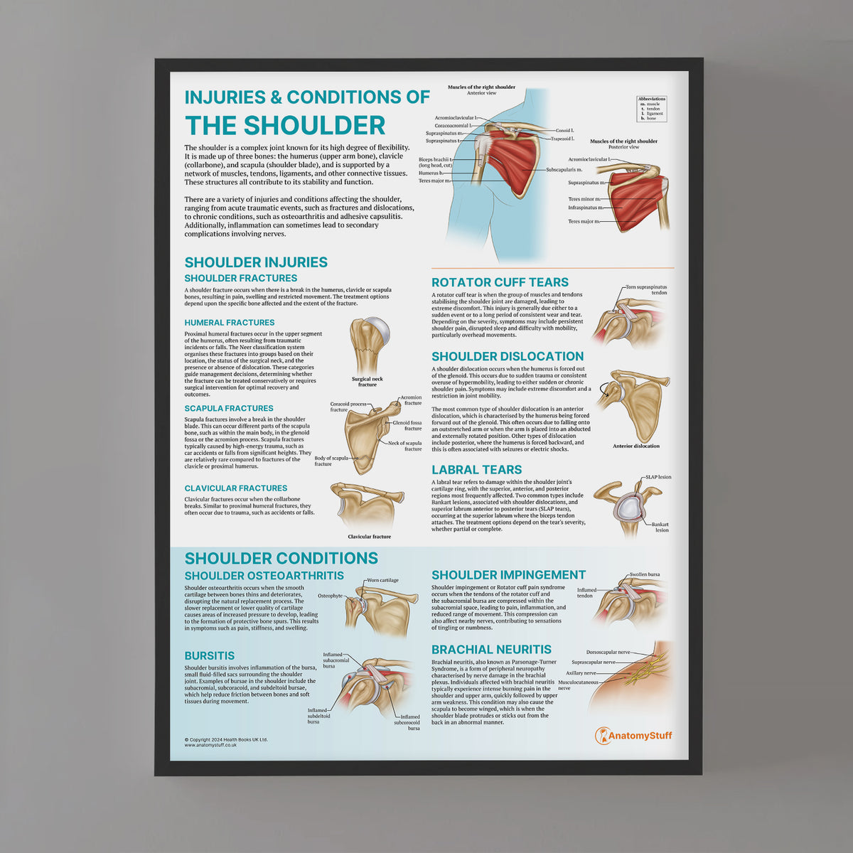 The Anatomy of The Shoulder Chart | Injuries & Conditions Poster ...