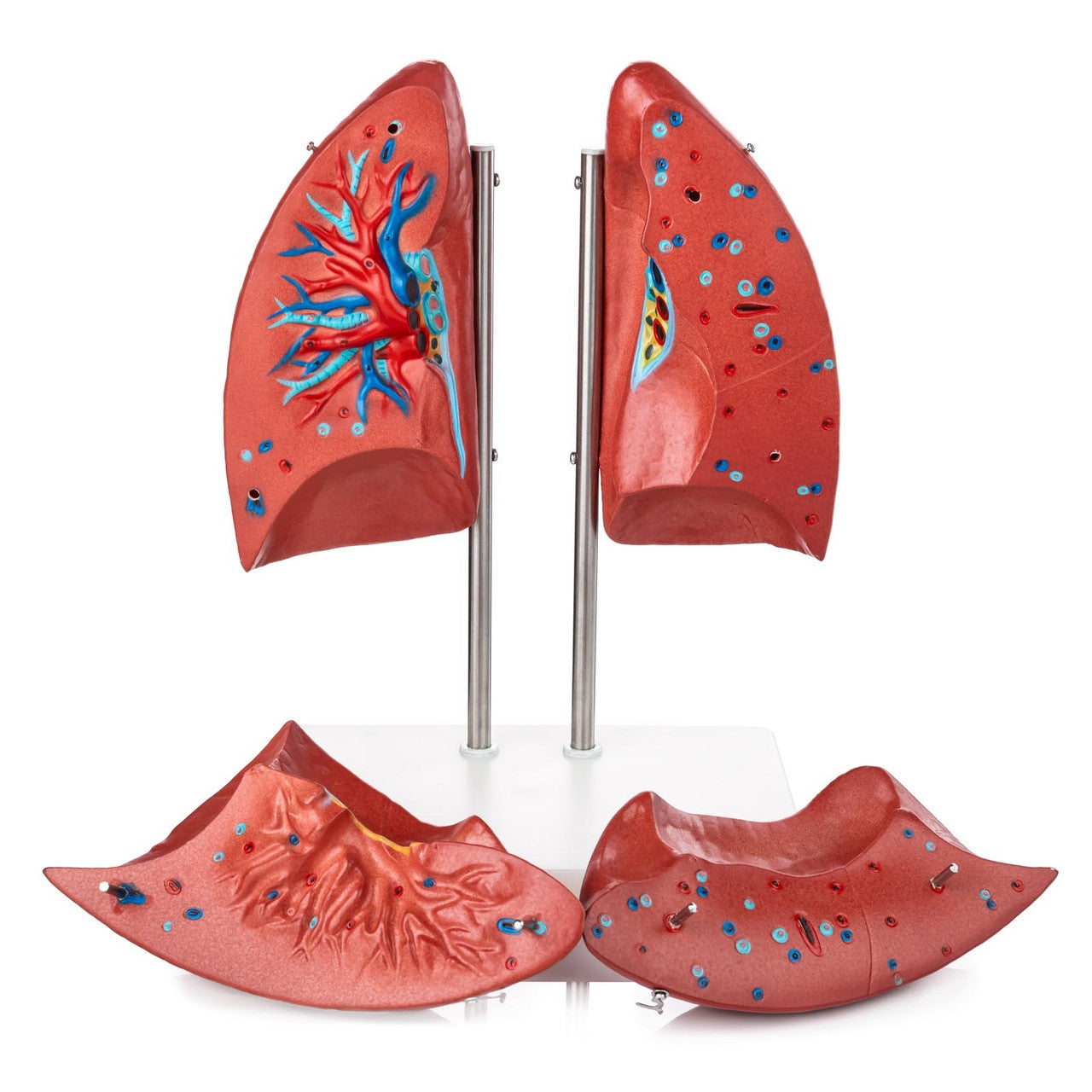 Budget Lungs Model (4 part) XC-321 | AnatomyStuff.co.uk | Plastic Lung ...