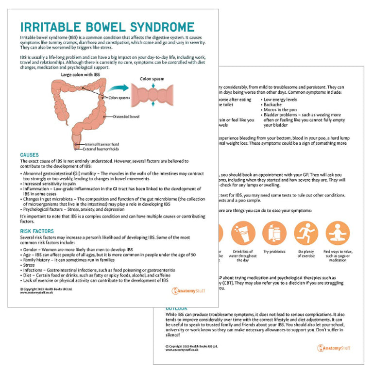 Irritable Bowel Syndrome Collection | IBS Charts & Models Set ...