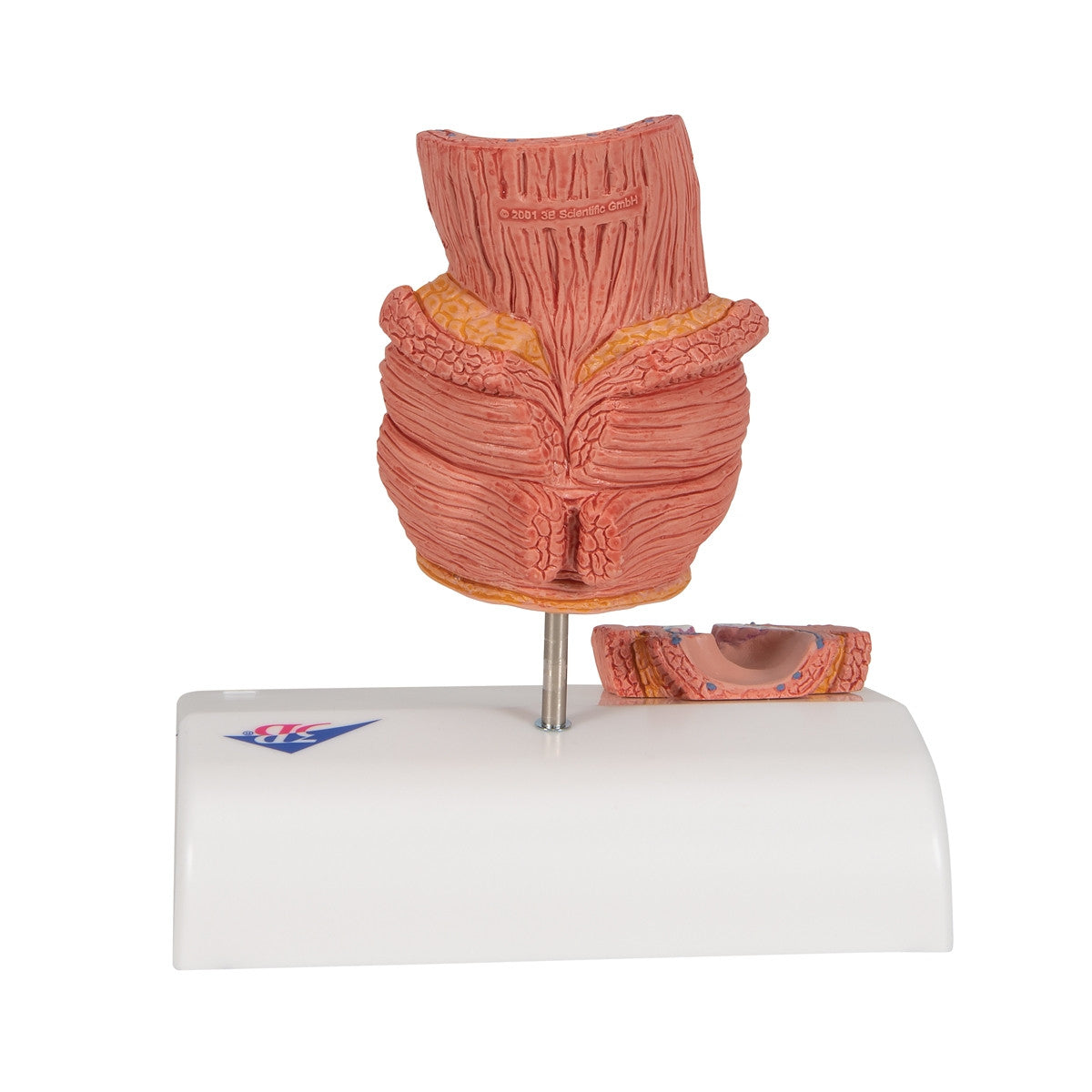 Haemorrhoid Anatomy Model K27 / 1000315 | Hemorrhoid Model | 3B ...