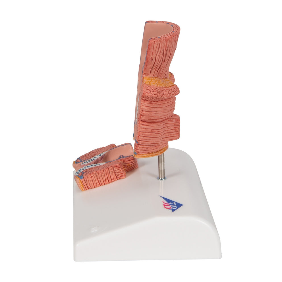 Haemorrhoid Anatomy Model K27 / 1000315 | Hemorrhoid Model | 3B ...