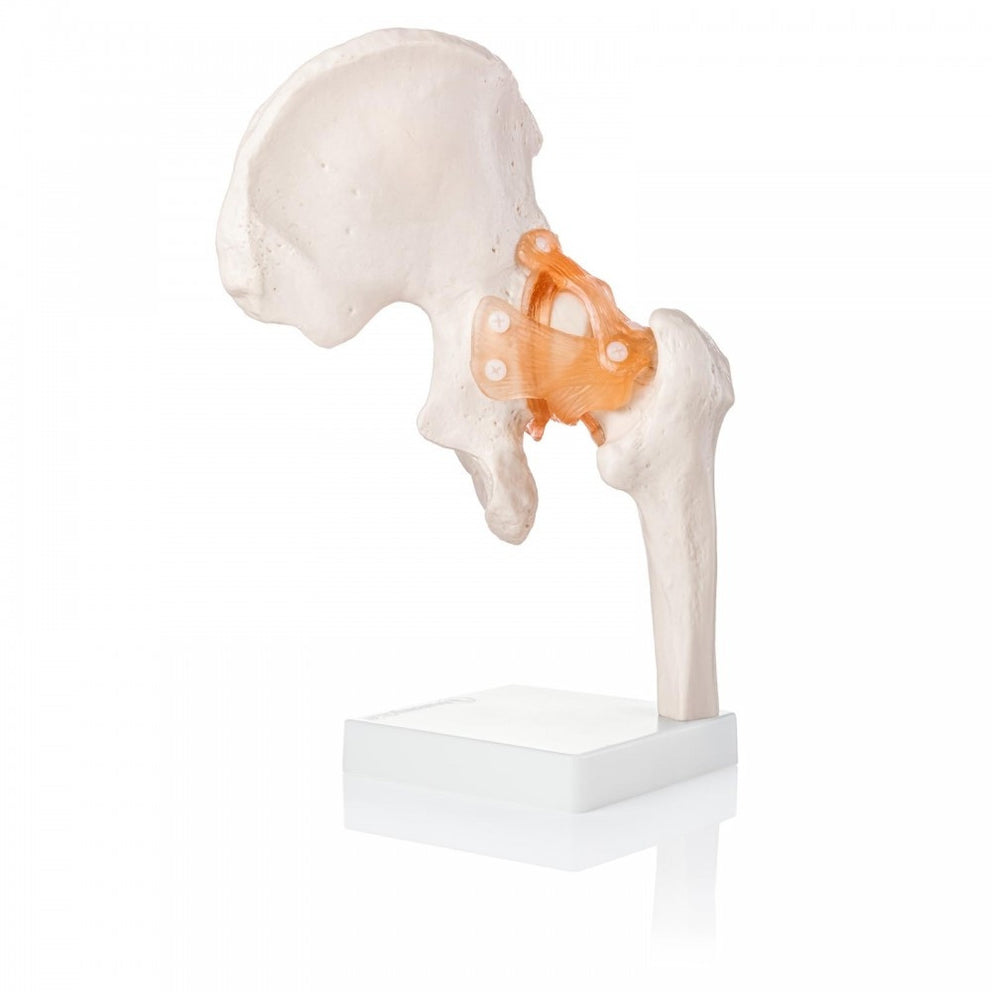 Hip Anatomy & Pathology Collection | Lower Limb Joint Models Charts ...