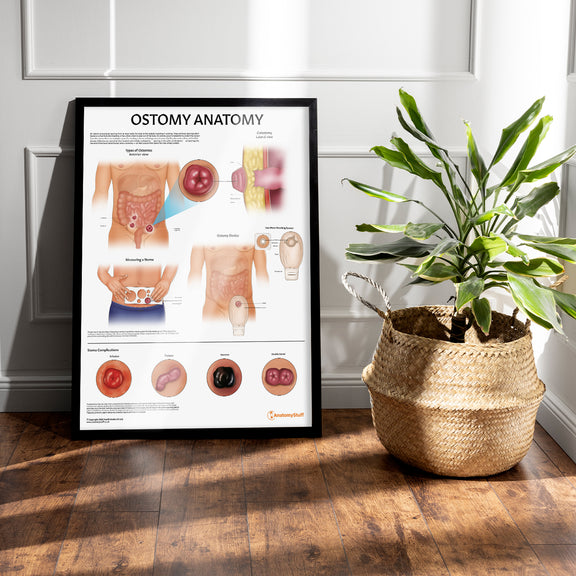 Ostomy Anatomy Chart | Anatomy Of An Ostomy Poster – AnatomyStuff