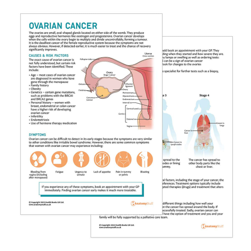 Ovarian Cancer Patient Education Handout (Printable PDF) | Female ...