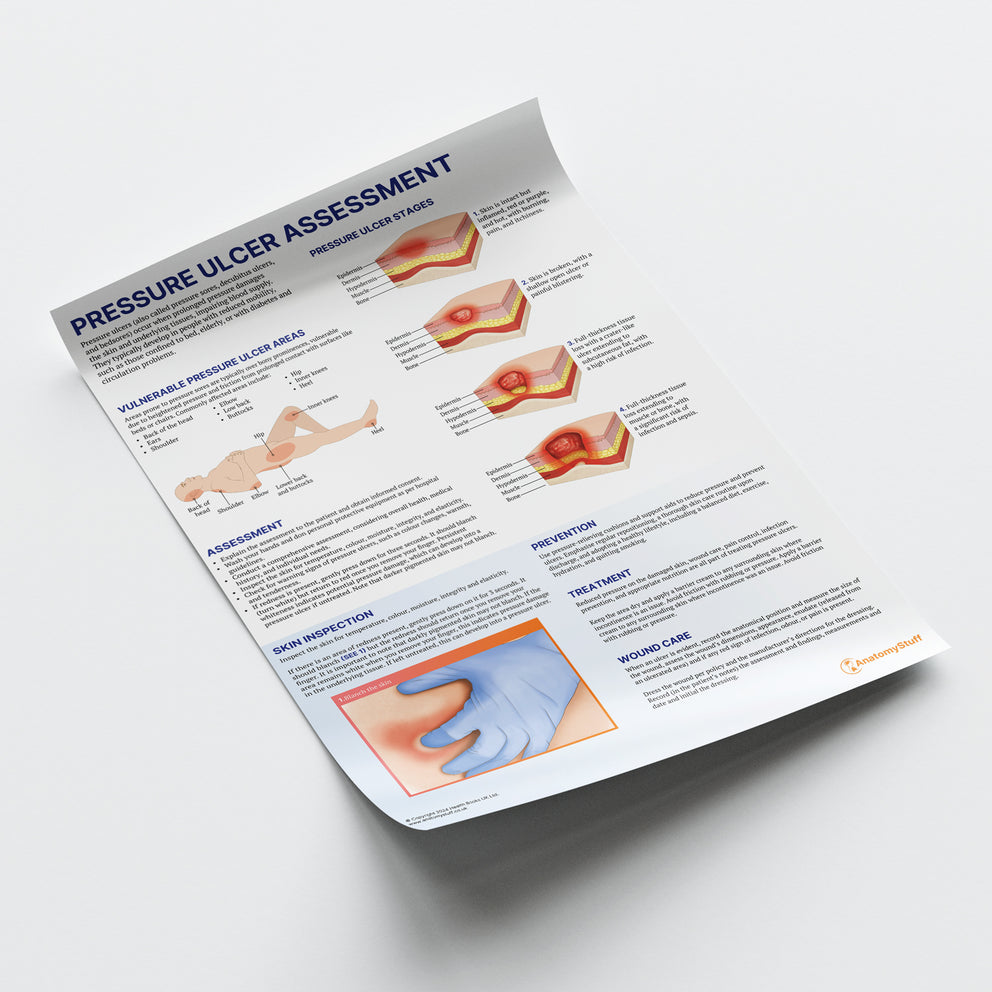 Pressure Ulcer Assessment Poster | AnatomyStuff