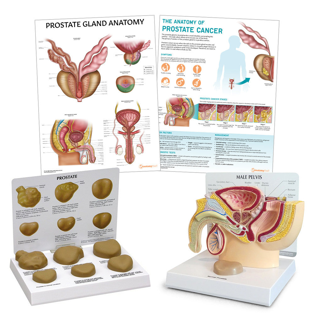 Prostate Anatomy & Pathology Collection | Urology Models | AnatomyStuff