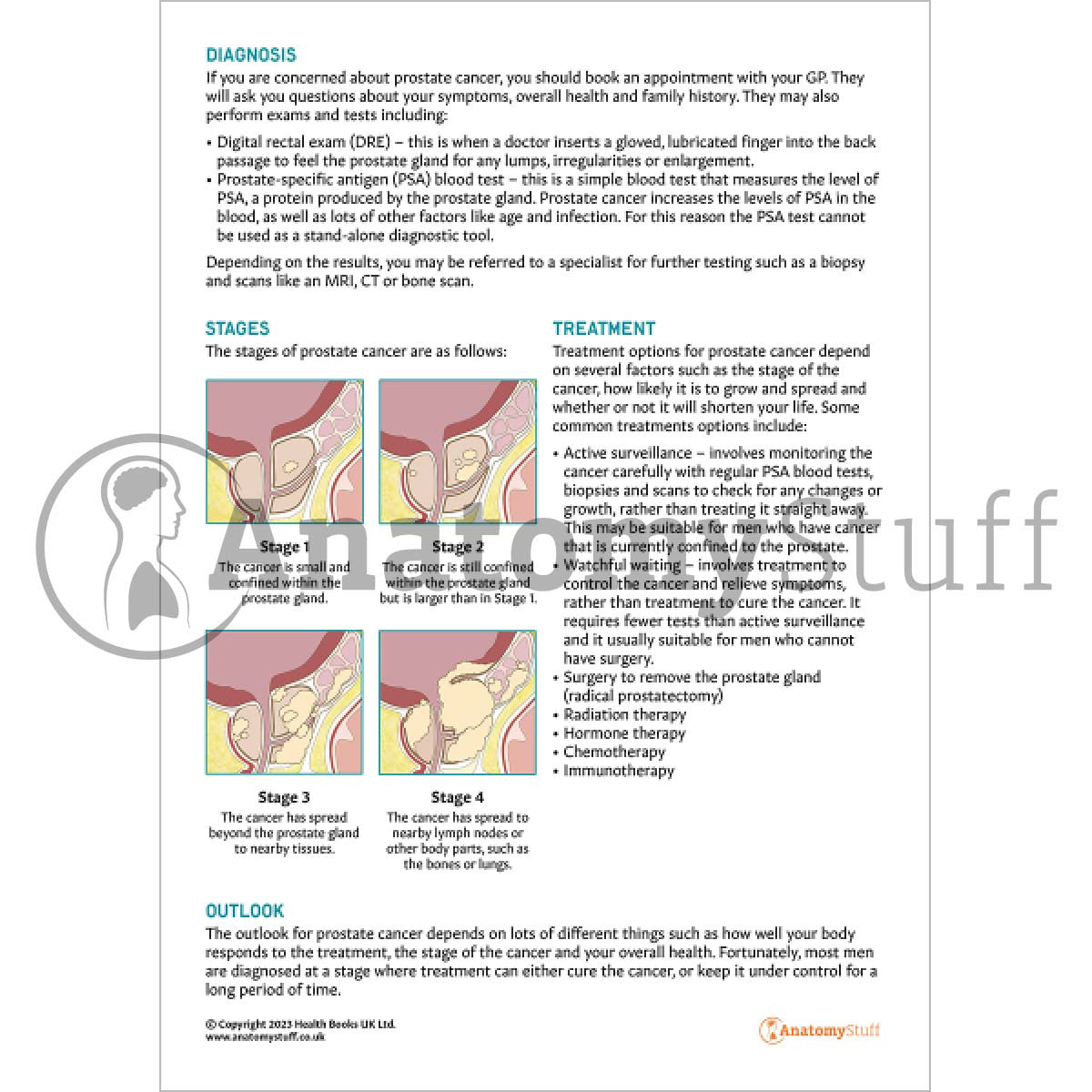 Prostate Cancer Patient Education Handout | AnatomyStuff
