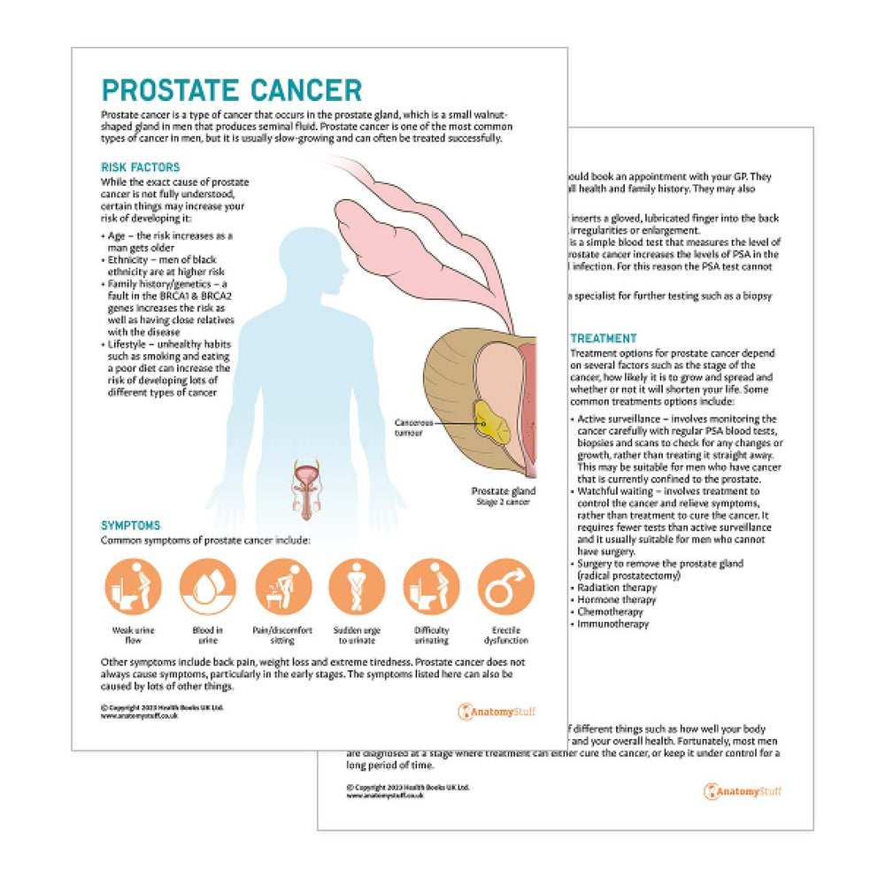 Prostate Cancer Patient Education Handout | AnatomyStuff