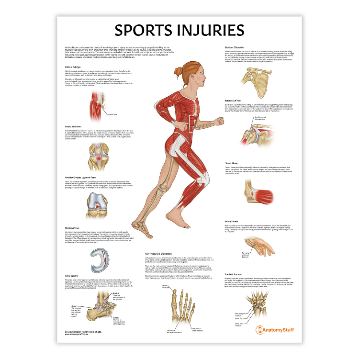 Sports Injuries Poster | Exercise Injury Dislocation Fracture Sprain ...