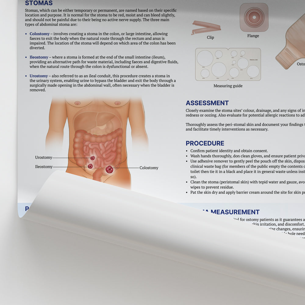 Stoma Care Chart | Ostomy Assessment Poster | AnatomyStuff