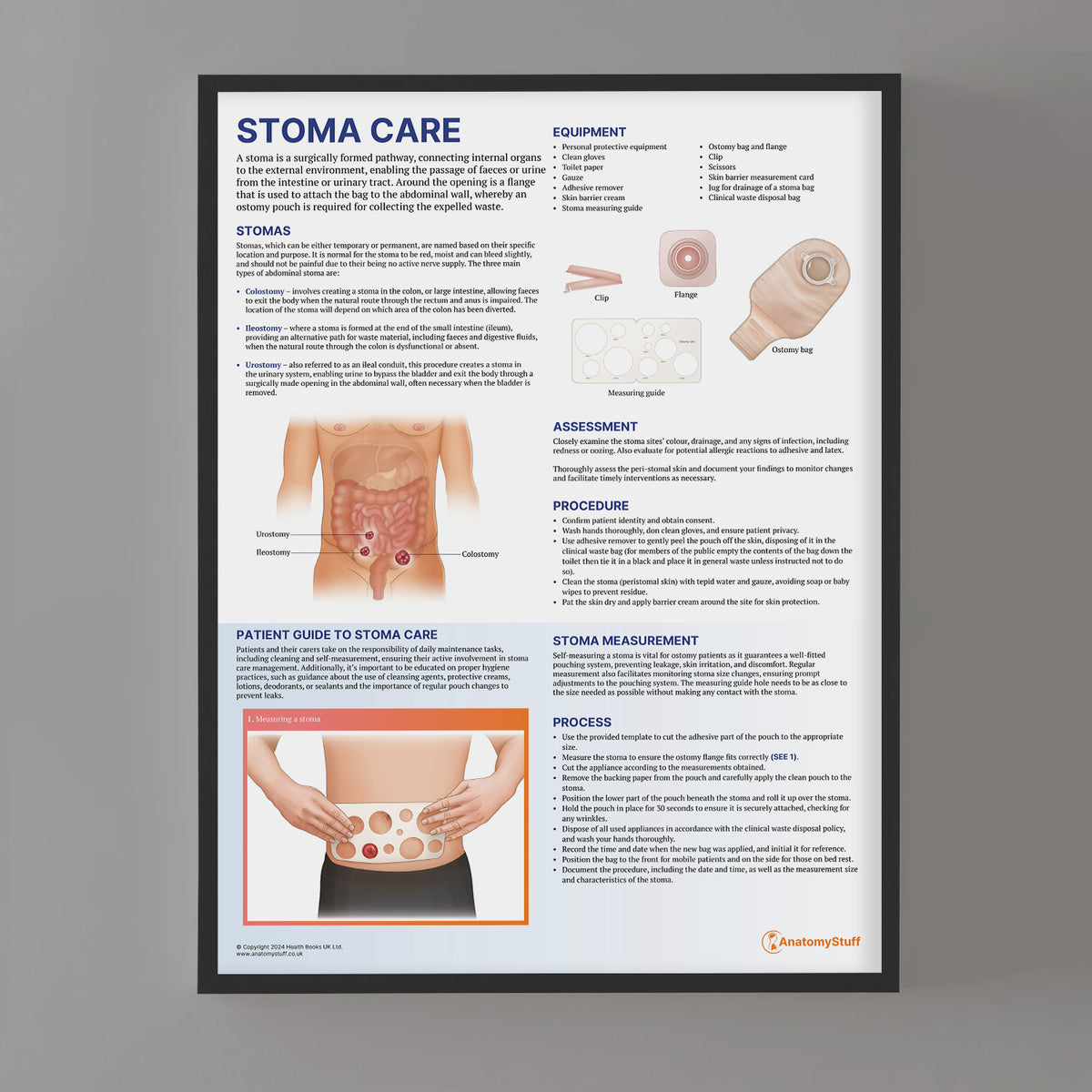 Stoma Care Chart | Ostomy Assessment Poster | AnatomyStuff
