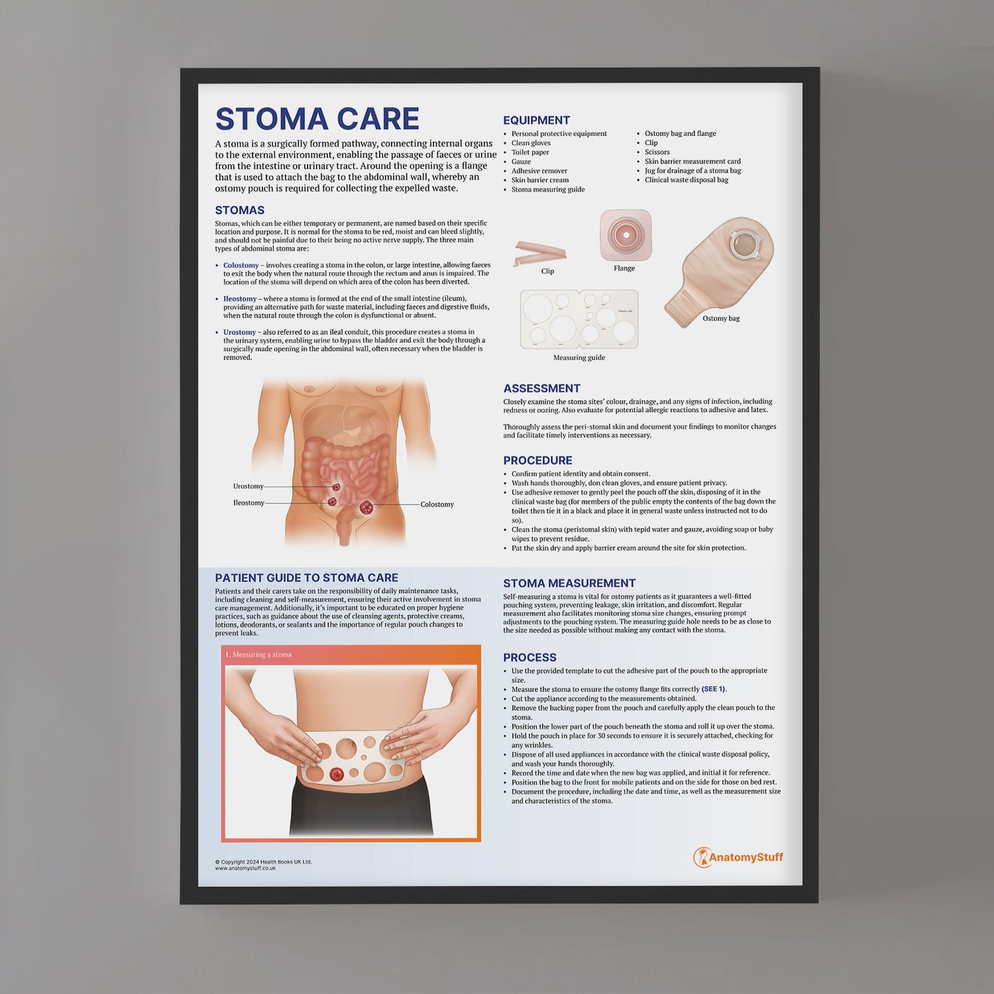 Stoma Care Chart | Ostomy Assessment Poster | AnatomyStuff