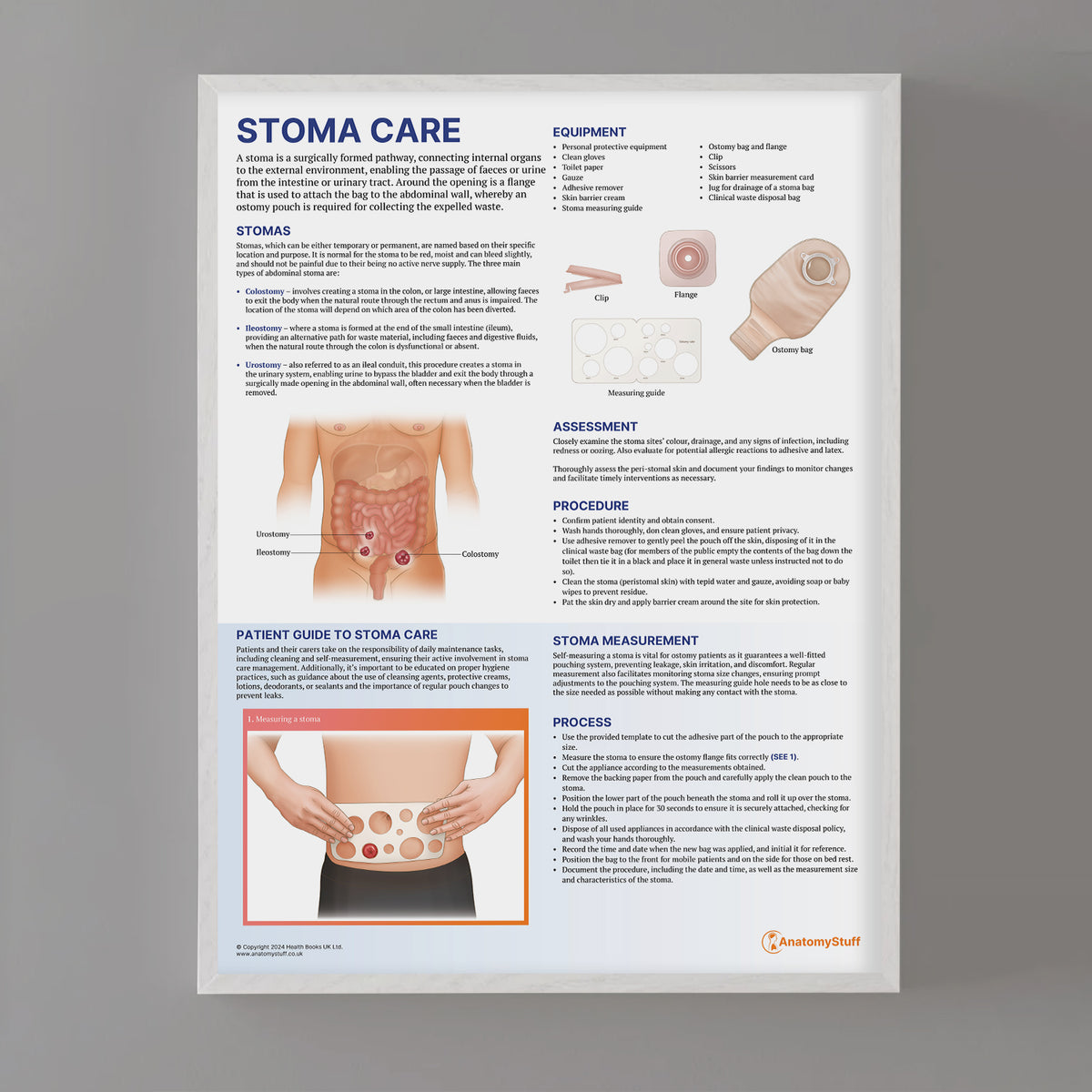 Stoma Care Chart | Ostomy Assessment Poster | AnatomyStuff