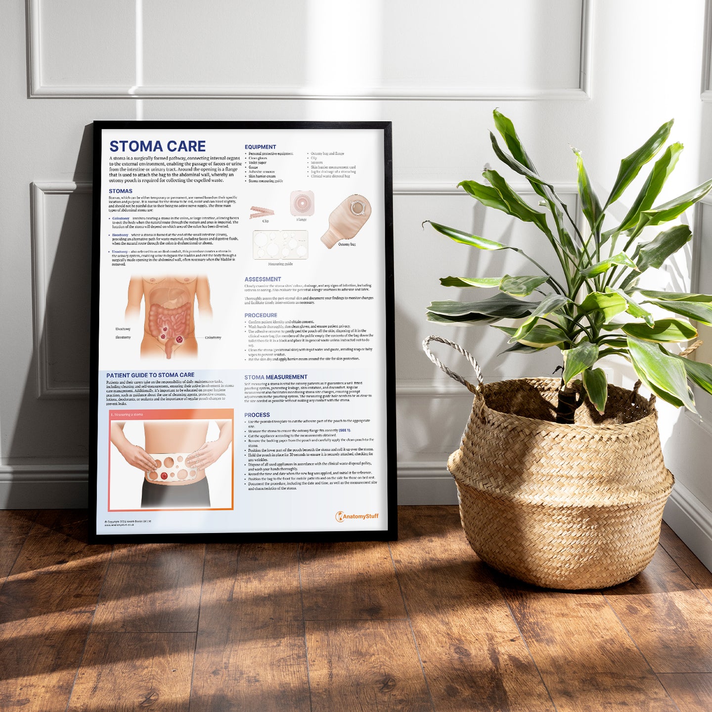 Stoma Care Chart | Ostomy Assessment Poster | AnatomyStuff