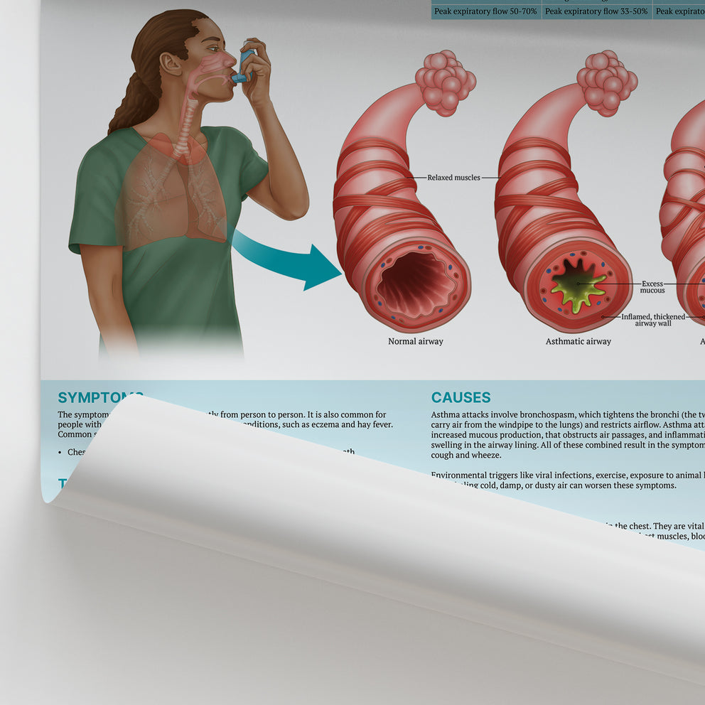 Asthma Inhaler Chart Understanding Asthma Anatomical Chart In Spanish ...