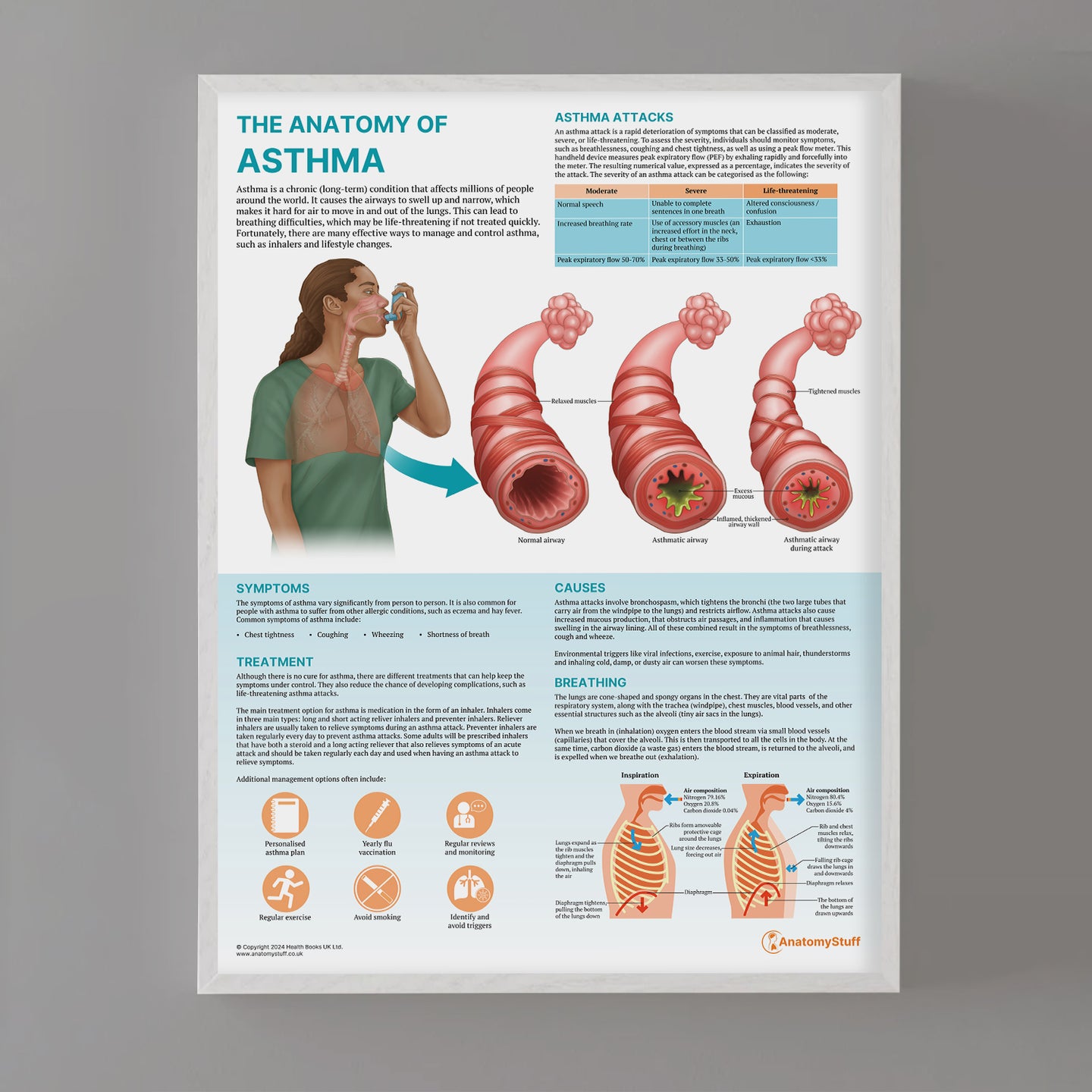 The Anatomy of Asthma Chart / Poster - | AnatomyStuff