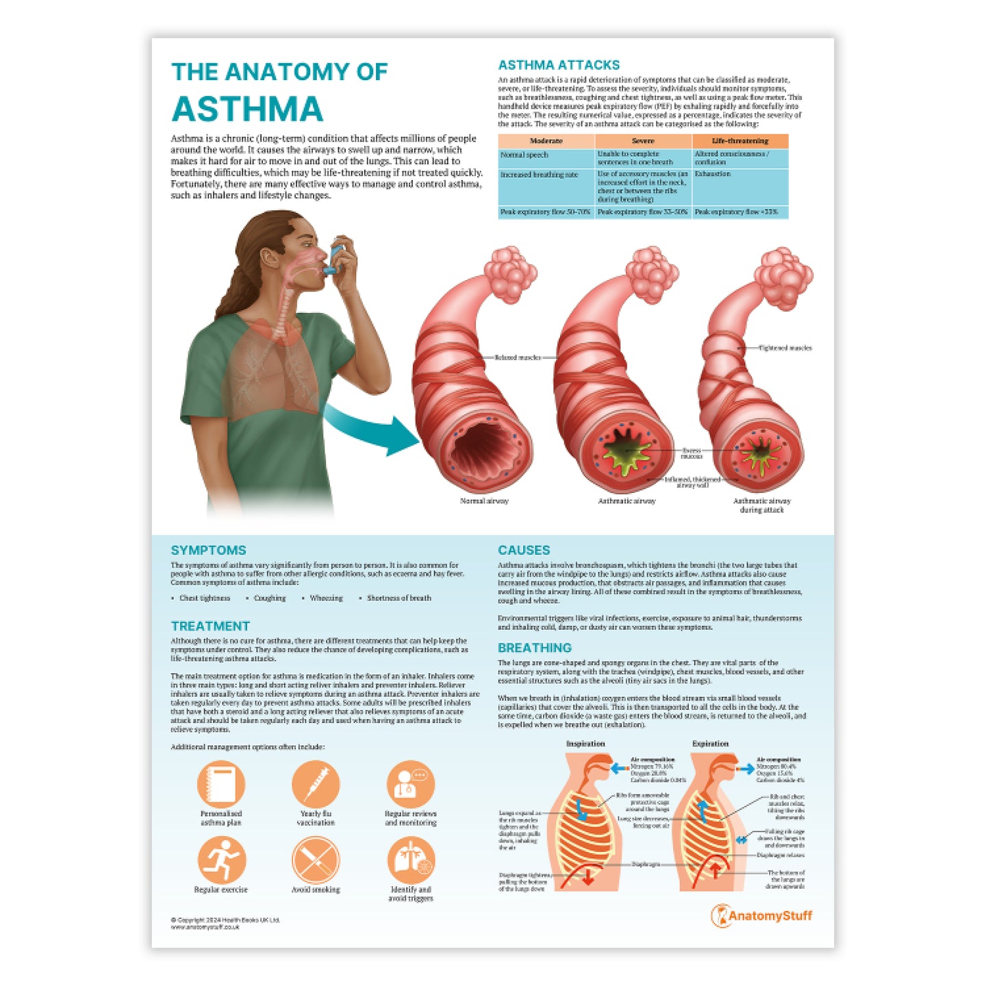 The Anatomy of Asthma Chart / Poster - | AnatomyStuff
