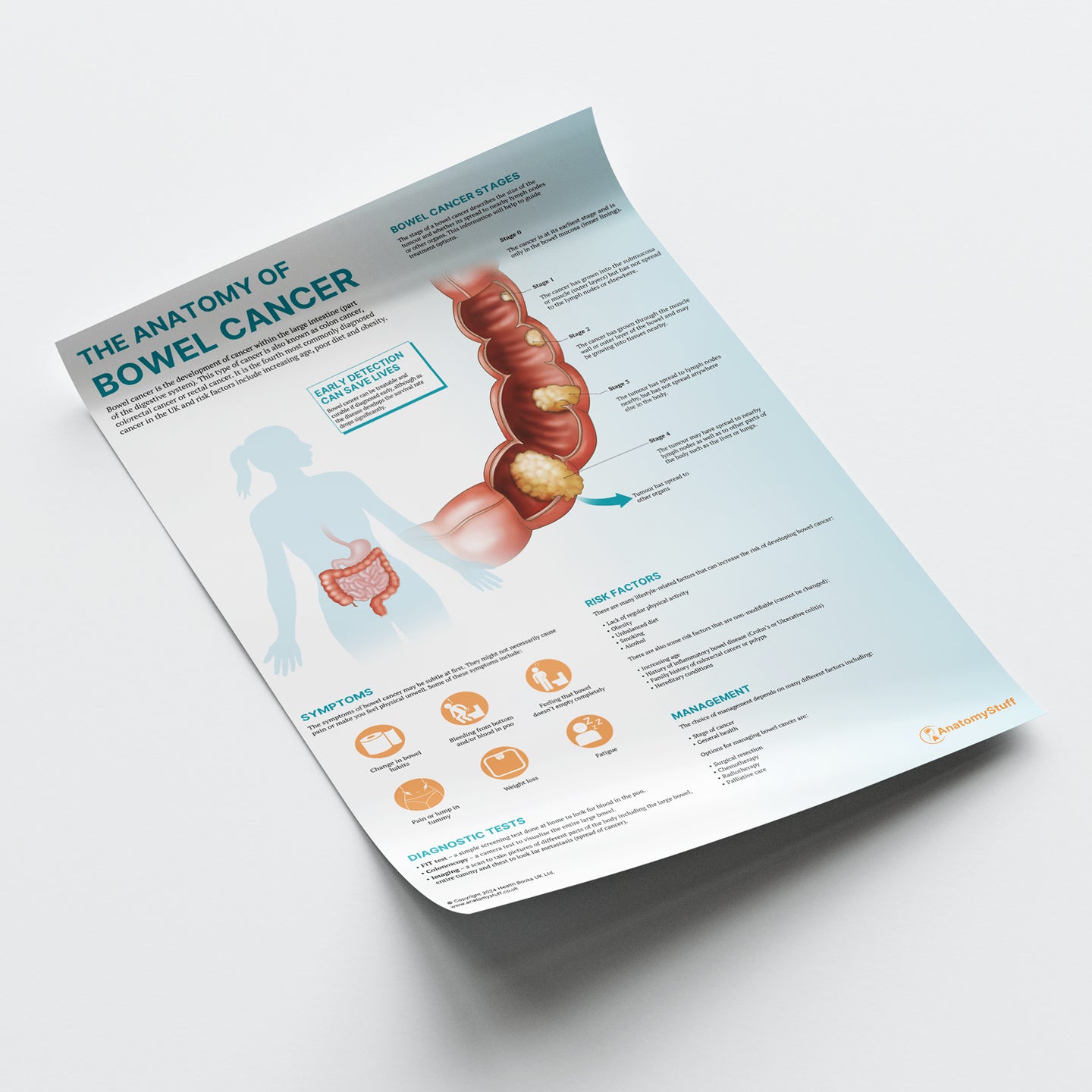 The Anatomy of Bowel Cancer Chart/Poster Laminated | Gastroenterology ...