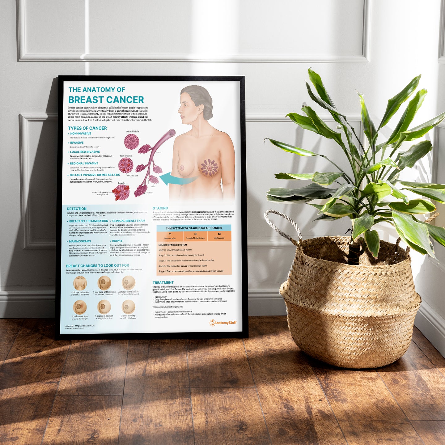 The Anatomy Of Breast Cancer Chart | Breast Cancer Awareness Chart ...