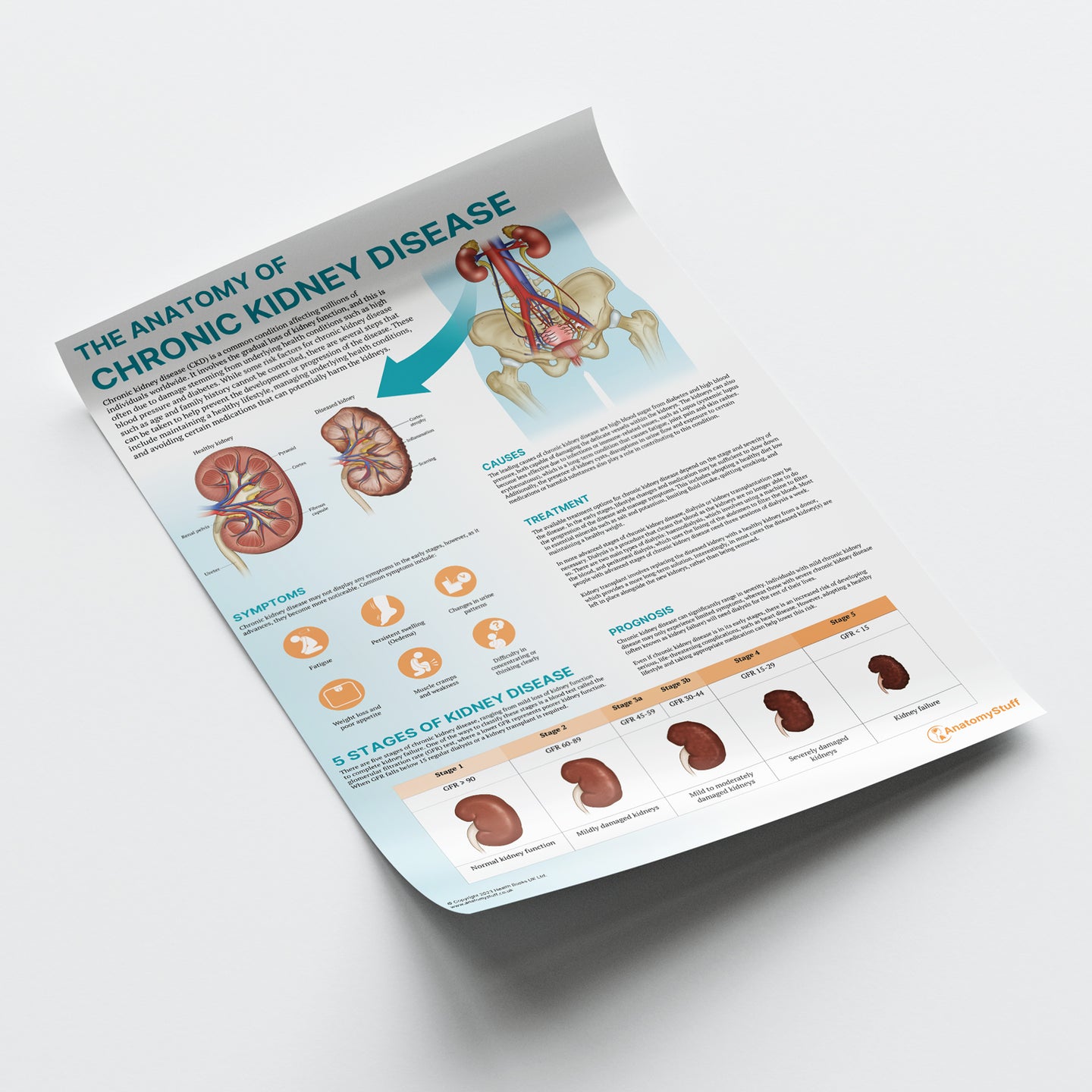 The Anatomy of Chronic Kidney Disease Chart/Poster Laminated – AnatomyStuff