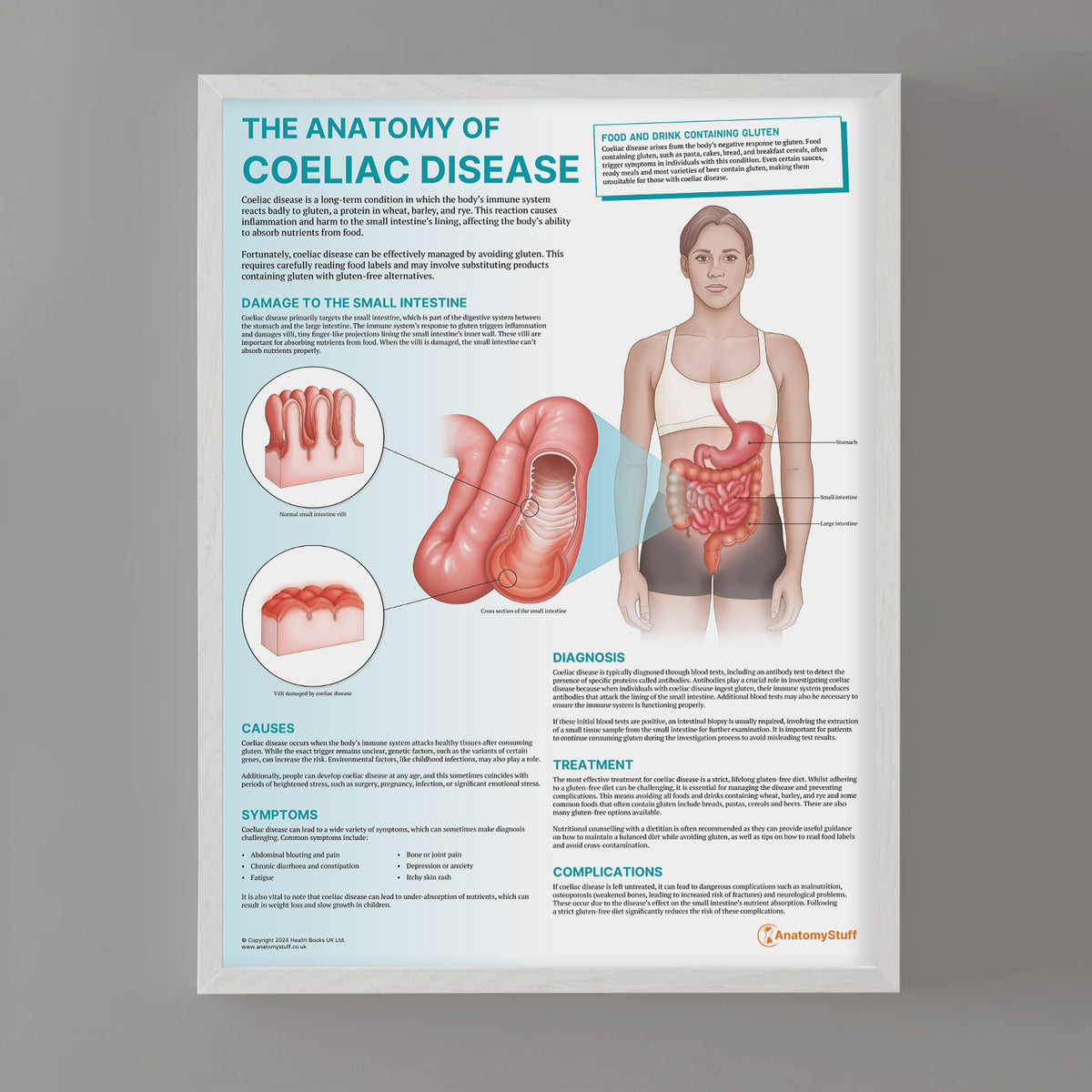 The Anatomy of Coeliac Chart/Poster | AnatomyStuff