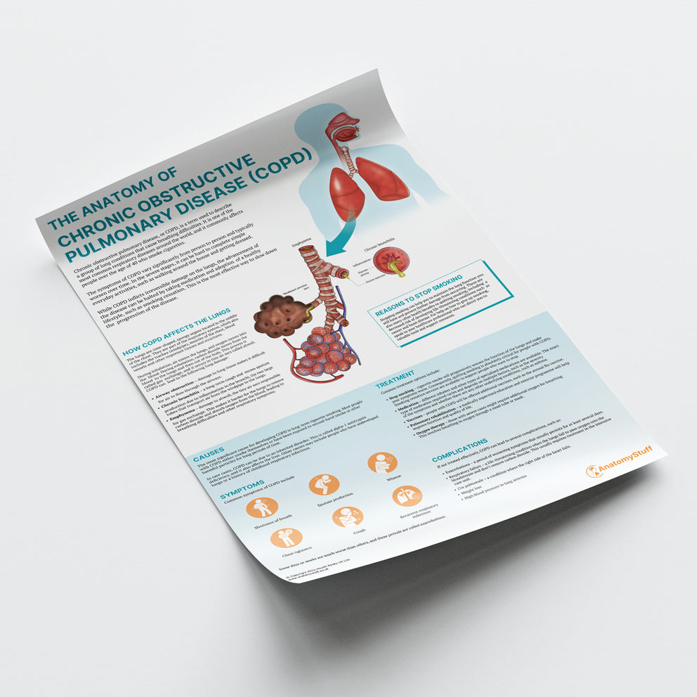 The Anatomy of COPD Chart/Poster ‚Äì Laminated | Respiratory Pathology ...
