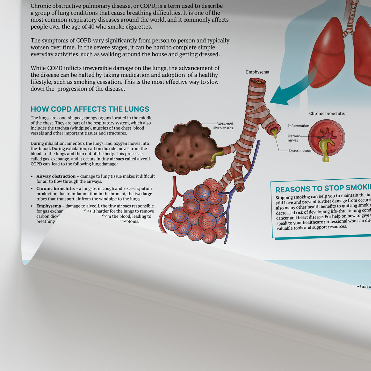 The Anatomy of COPD Chart/Poster ‚Äì Laminated | Respiratory Pathology ...