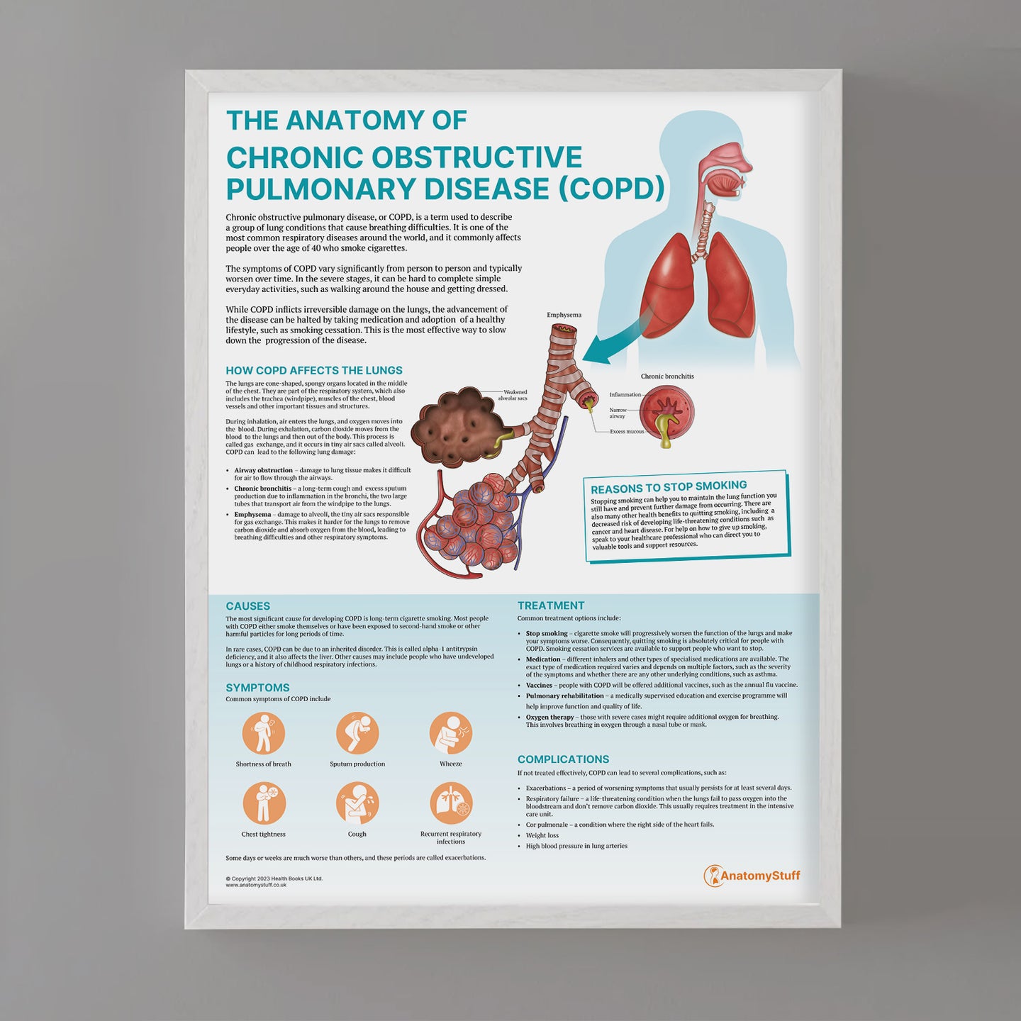 The Anatomy of COPD Chart/Poster ‚Äì Laminated | Respiratory Pathology ...