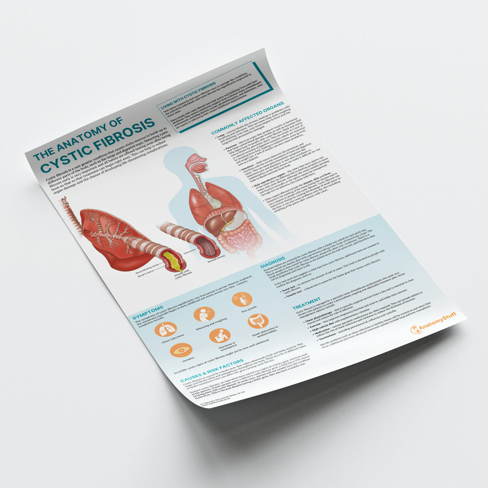 The Anatomy of Cystic Fibrosis Chart/Poster ‚Äì Laminated | Respiratory ...
