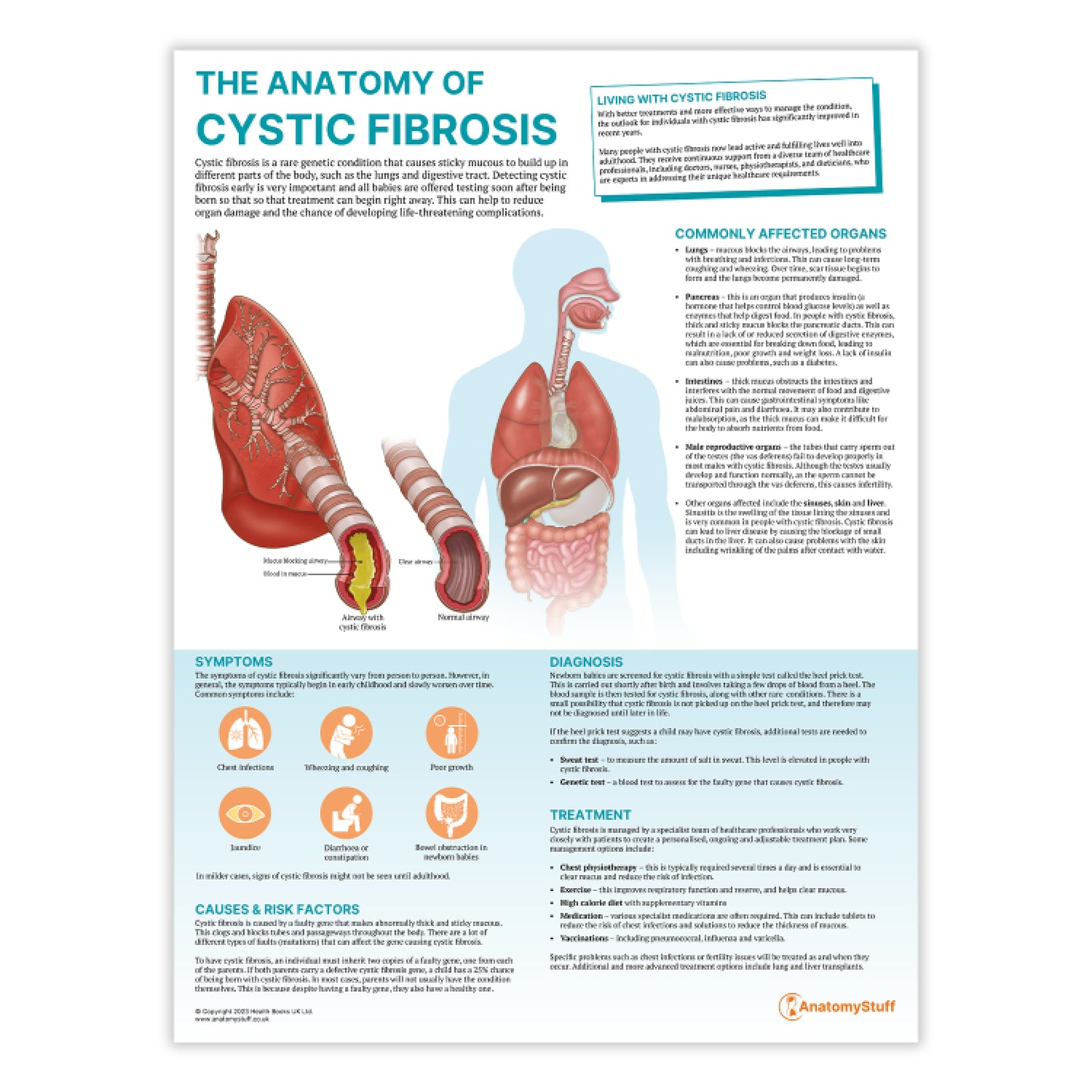 The Anatomy of Cystic Fibrosis Chart/Poster ‚Äì Laminated | Respiratory ...