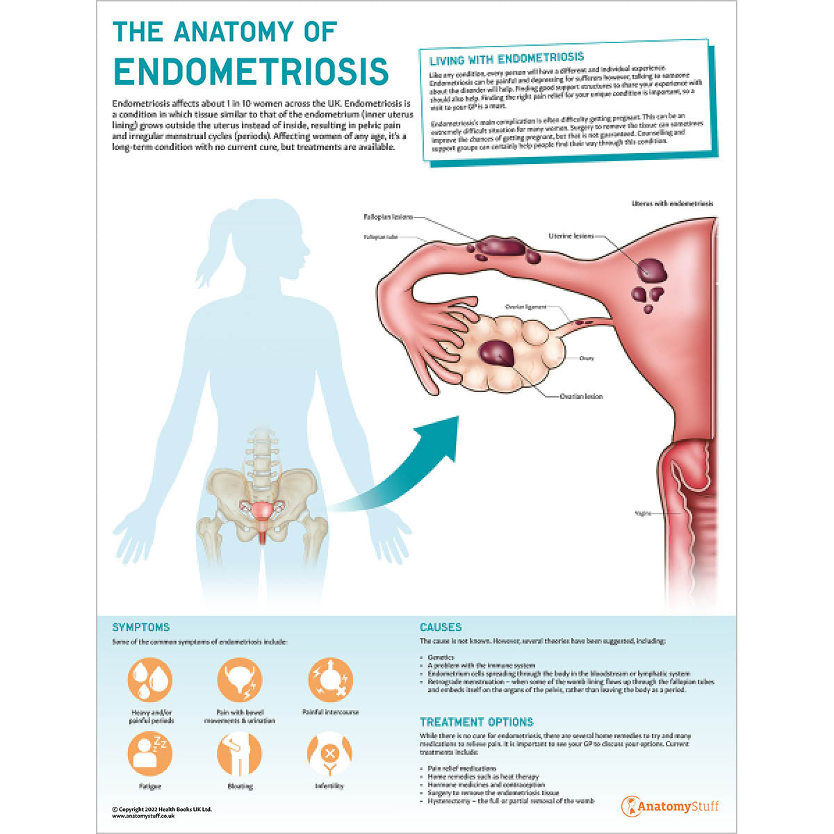 Female Reproductive System Anatomy & Pathology Collection – AnatomyStuff