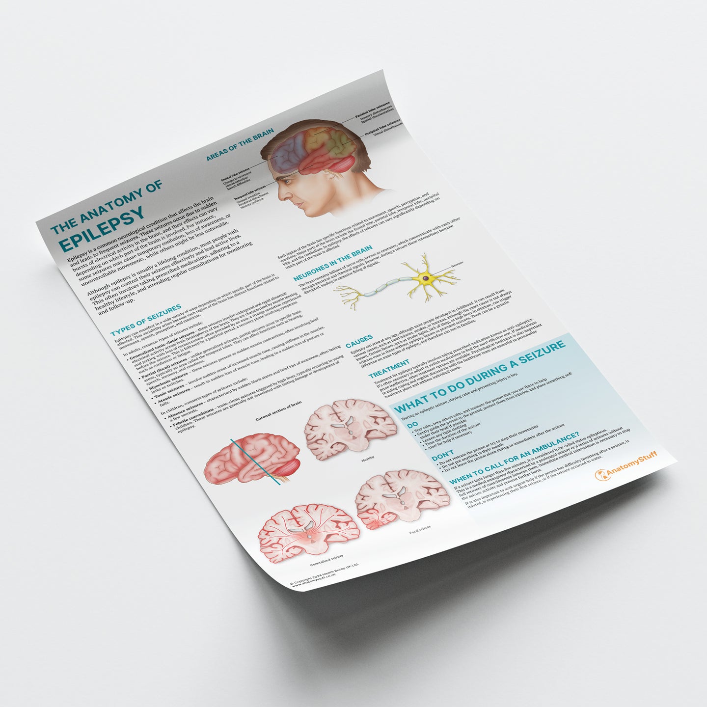 The Anatomy of Epilepsy Chart / Poster - | AnatomyStuff