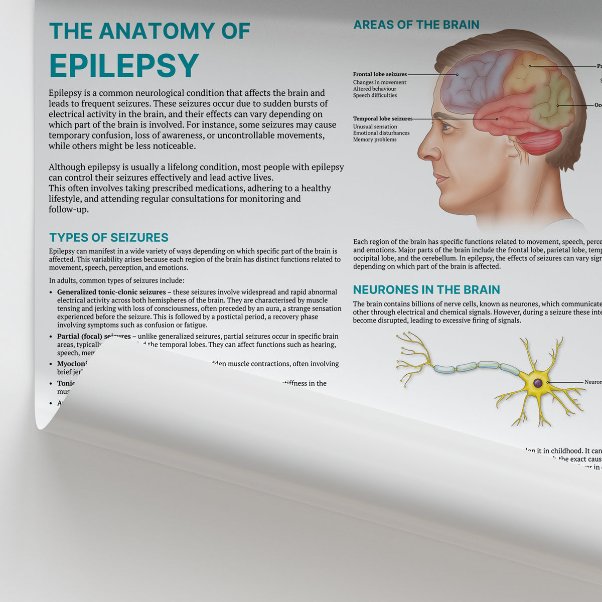 The Anatomy of Epilepsy Chart / Poster - | AnatomyStuff